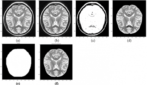 Automatic Skull Stripping of MRI Head Images Based on Adaptive Gamma ...
