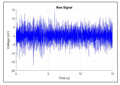 Classification and Detection of Cognitive Disorders like Depression and ...