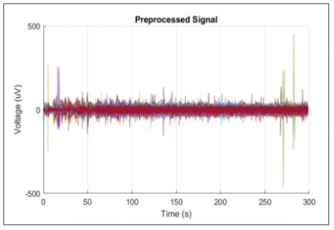 Classification and Detection of Cognitive Disorders like Depression and ...