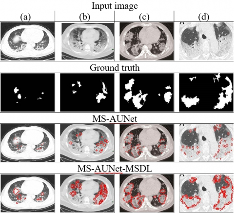 Sparse Dynamic Deep Neural Network in Marginal Shape Space for Accurate ...