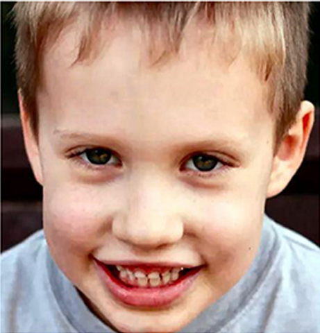 Autism Spectrum Disorder Detection Using Facial Images and Deep ...