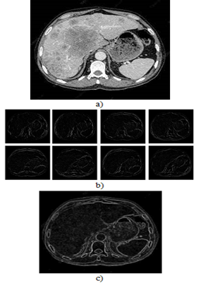 ESP-UNet: Encoder-Decoder Convolutional Neural Network with Edge-Enhanced Features for Liver ...